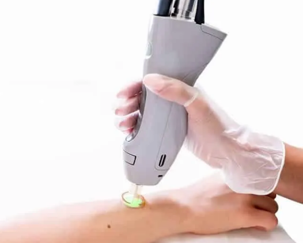 What Questions Should You Ask During a Laser Hair Removal Consultation ...