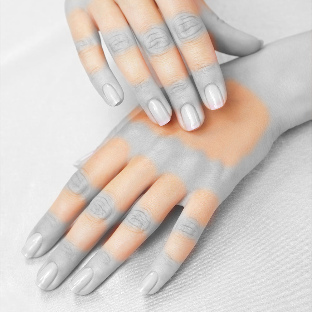 Hands Laser Hair Removal – Satori Laser